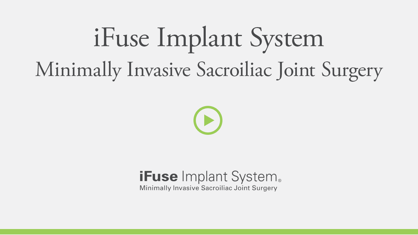 iFuse: The Triangle-Shaped Implant Designed Specifically for the SI ...