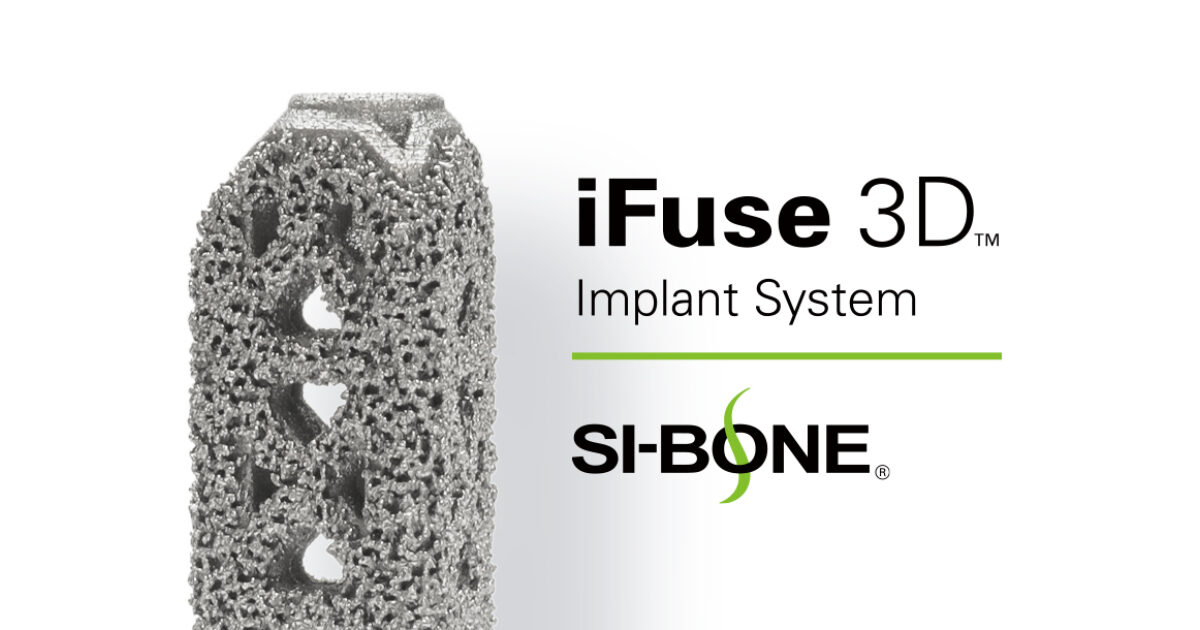 iFuse 3D™ | SI-BONE