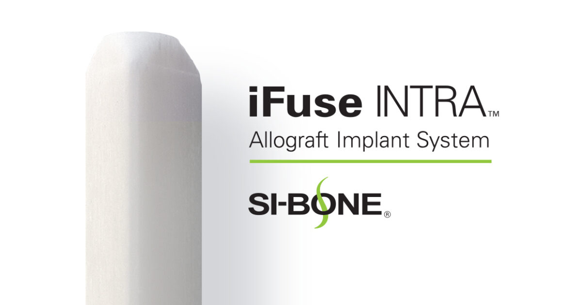 iFuse INTRA TM | SI-BONE
