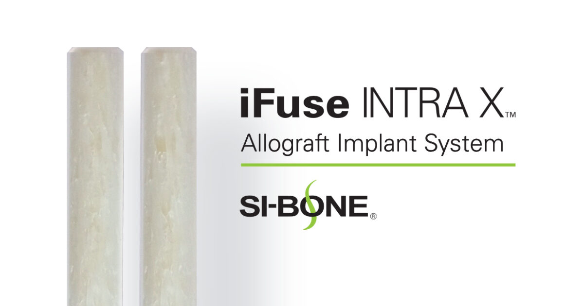 iFuse INTRA X® | SI-BONE