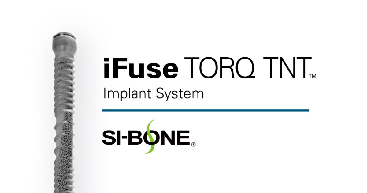 Ifuse Torq Tnt™ Implant System Si Bone