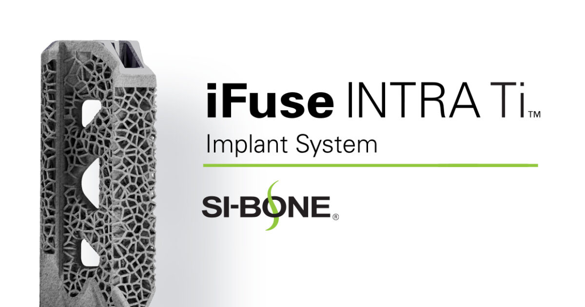 iFuse INTRA Ti™ | SI-BONE