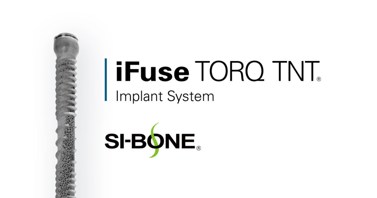 iFuse TORQ TNT® | SI-BONE