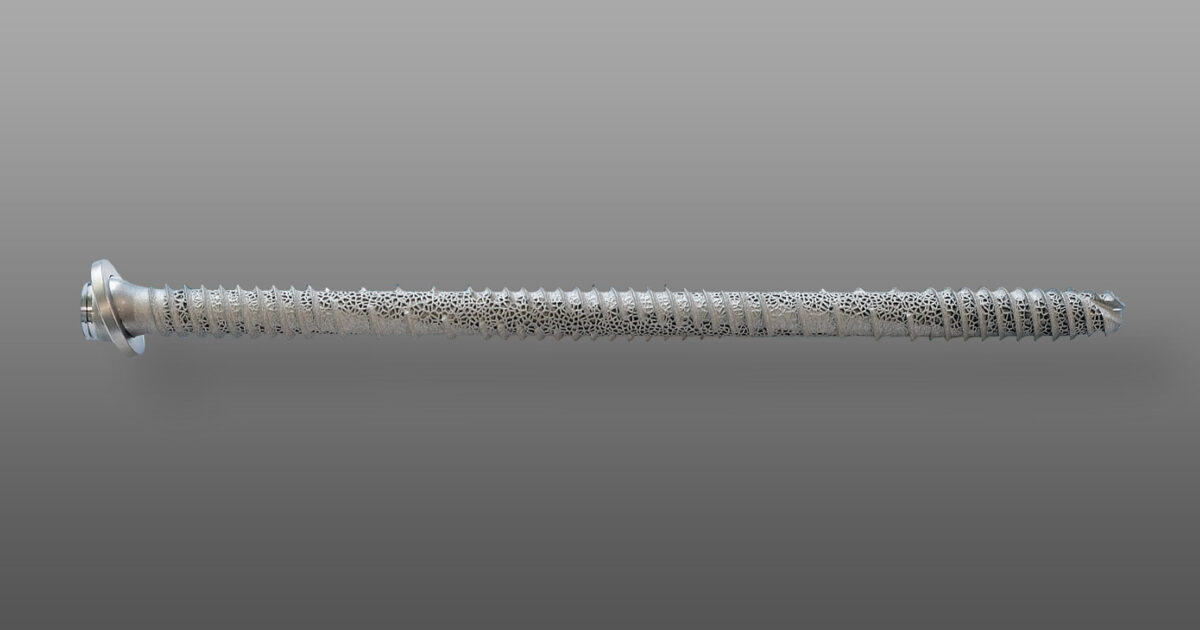 iFuse TORQ TNT™ Implant System | SI-BONE