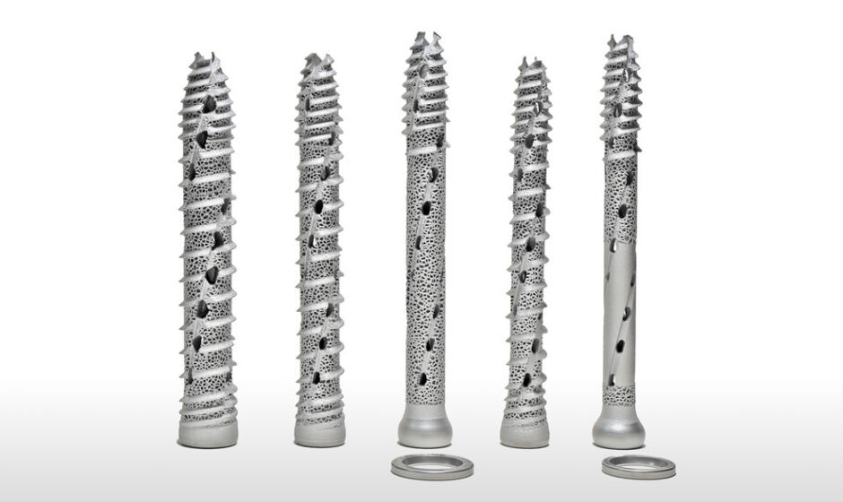 Sacropelvic Solutions for Musculoskeletal Disorders | SI-BONE
